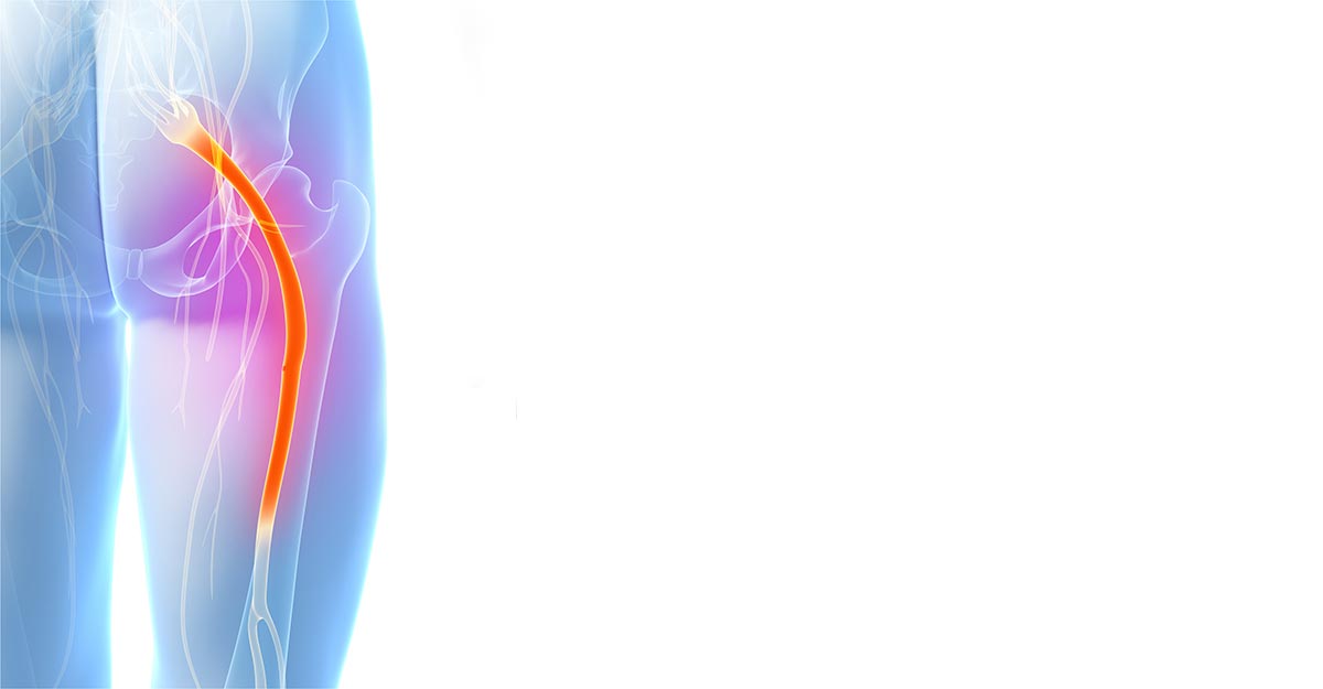 Quicker Sciatica Healing with Chiropractic Adjustments | Chesapeake ...